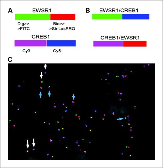 EWSR1-CREB1 and EWSR1-ATF1 Fusion Genes in Angiomatoid Fibrous ...