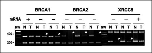 Epigenetic Inactivation of the Chromosomal Stability Control Genes ...
