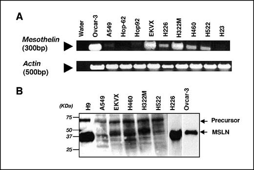 Mesothelin Expression in Human Lung Cancer | Clinical Cancer Research ...