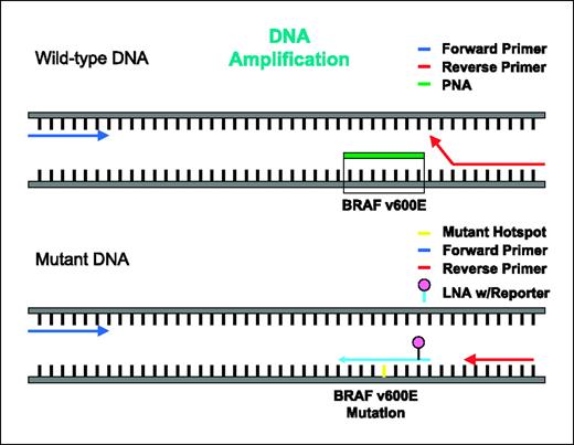 Utility of Circulating B-RAF DNA Mutation in Serum for Monitoring ...
