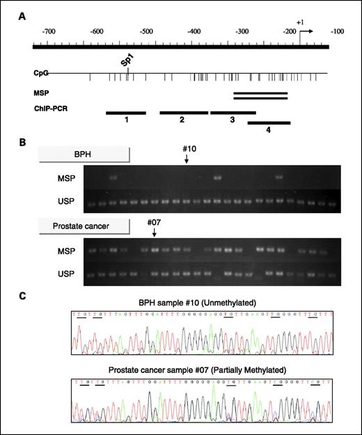 Epigenetic Modifications of RASSF1A Gene through Chromatin Remodeling ...