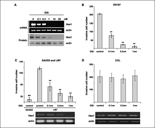 Critical Role of Notch Signaling in Osteosarcoma Invasion and ...