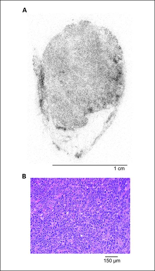 Preclinical Evaluation of the α-Particle Generator Nuclide 225Ac for ...