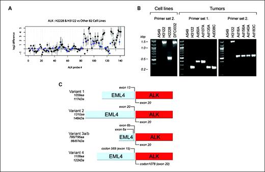EML4-ALK Fusion Gene and Efficacy of an ALK Kinase Inhibitor in Lung ...