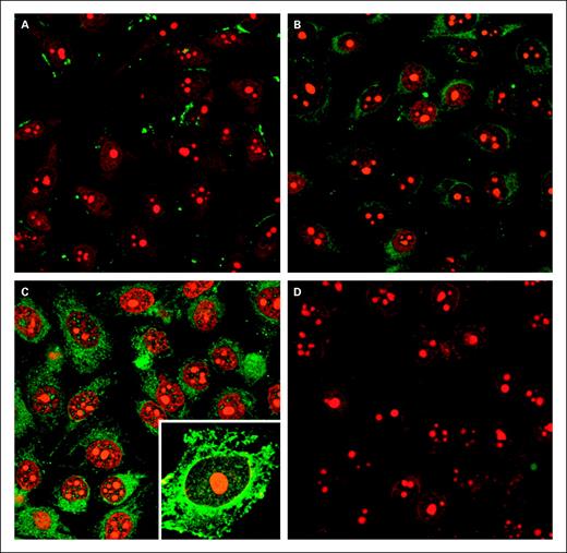 TMTP1, a Novel Tumor-Homing Peptide Specifically Targeting Metastasis ...