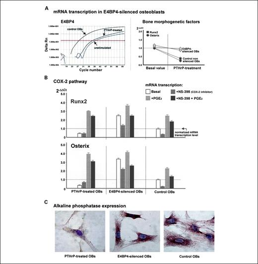 Negative Regulation of the Osteoblast Function in Multiple Myeloma ...