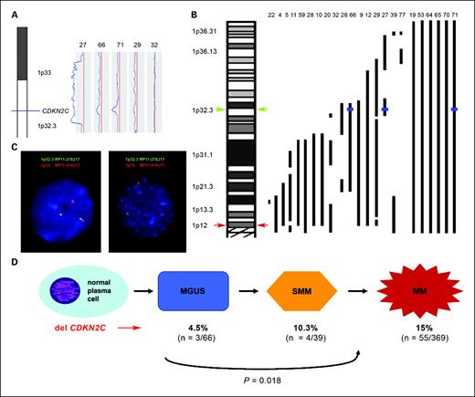Deletions of CDKN2C in Multiple Myeloma: Biological and Clinical ...