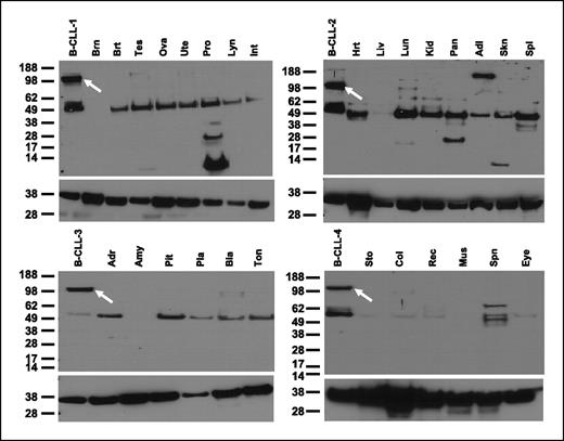 Unique Cell Surface Expression of Receptor Tyrosine Kinase ROR1 in ...