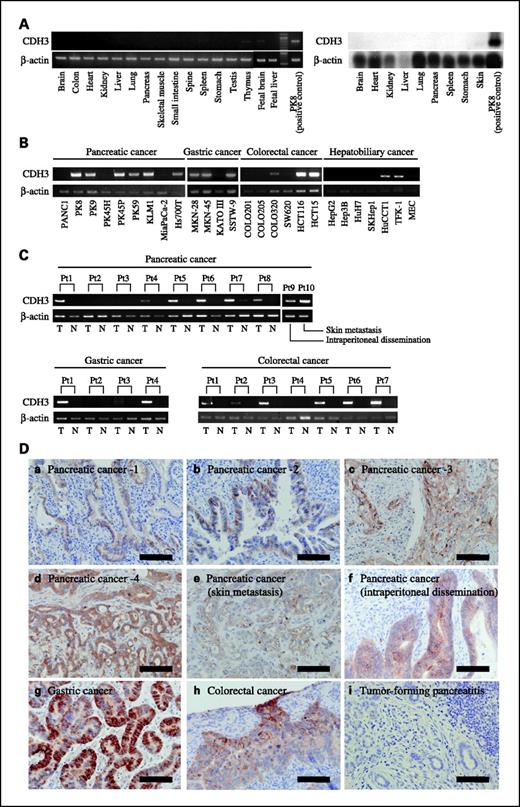 Identification of a Novel Tumor-Associated Antigen, Cadherin 3/P ...