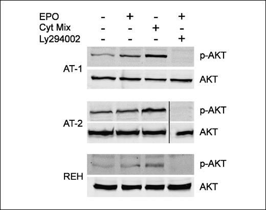 Role of the Erythropoietin Receptor in ETV6/RUNX1-Positive Acute ...