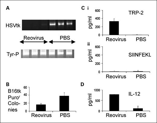 Tumor Infection by Oncolytic Reovirus Primes Adaptive Antitumor ...