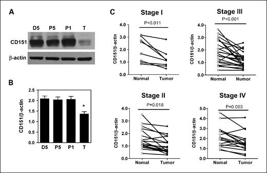 Regulation of CD151 by Hypoxia Controls Cell Adhesion and Metastasis in ...