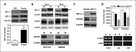 Regulation of CD151 by Hypoxia Controls Cell Adhesion and Metastasis in ...