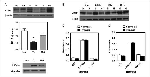 Regulation of CD151 by Hypoxia Controls Cell Adhesion and Metastasis in ...