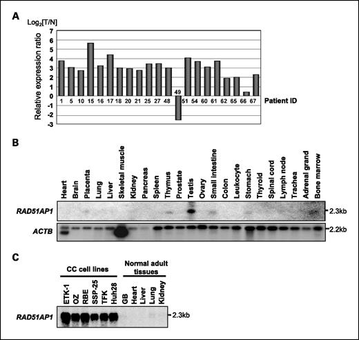 Enhanced Expression of RAD51 Associating Protein-1 Is Involved in the ...