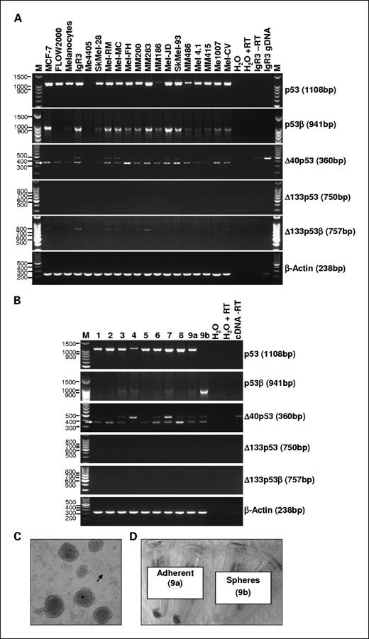 Small Molecular Weight Variants of p53 Are Expressed in Human Melanoma ...