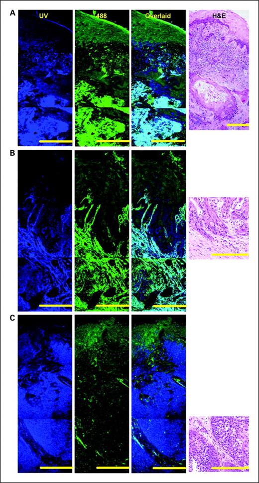 Understanding the Biological Basis of Autofluorescence Imaging for Oral ...