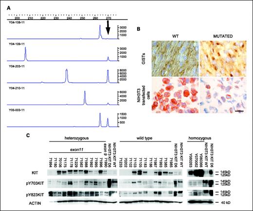 KIT Mutations Induce Intracellular Retention and Activation of an ...