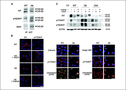 KIT Mutations Induce Intracellular Retention and Activation of an ...
