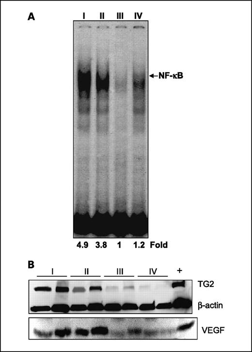 Therapeutic Significance of Elevated Tissue Transglutaminase Expression ...