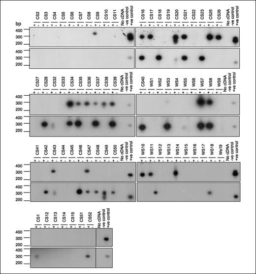 SCG3 Transcript in Peripheral Blood Is a Prognostic Biomarker for REST ...