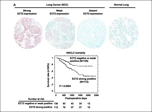 Involvement of Epithelial Cell Transforming Sequence-2 Oncoantigen in ...
