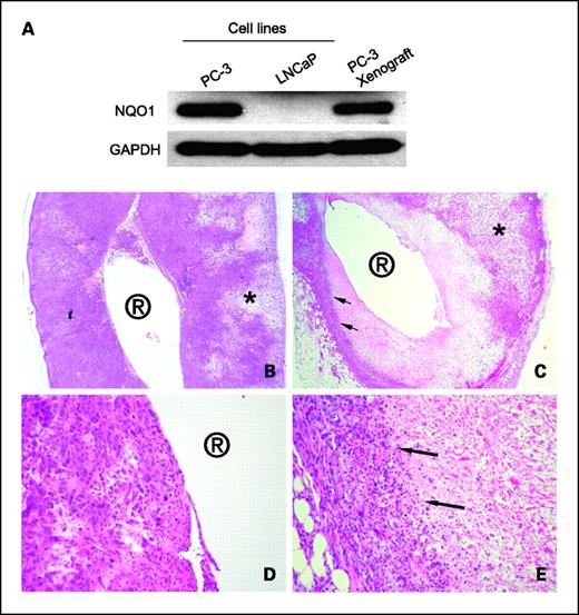 Intratumoral Delivery of β-Lapachone via Polymer Implants for Prostate ...