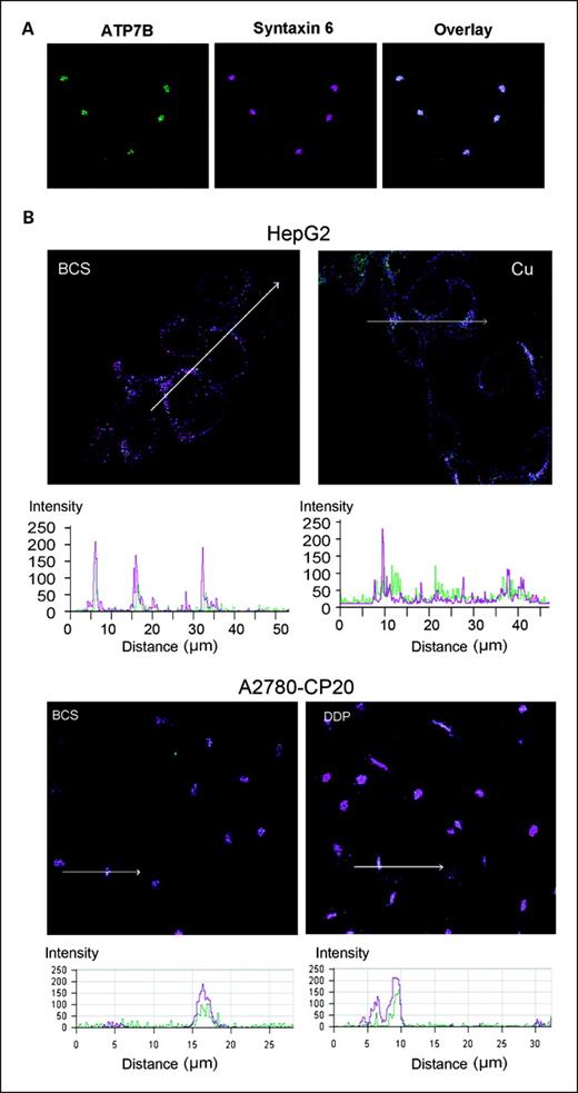 Therapeutic Targeting of ATP7B in Ovarian Carcinoma | Clinical Cancer ...