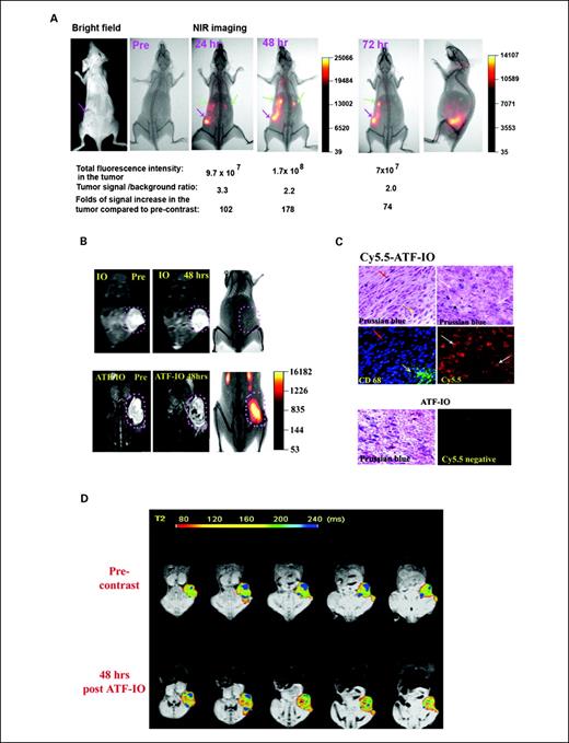 Receptor-Targeted Nanoparticles for In vivo Imaging of Breast Cancer ...
