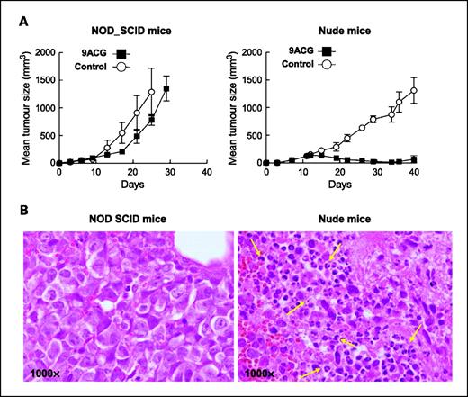 Antiangiogenesis Targeting Tumor Microenvironment Synergizes ...
