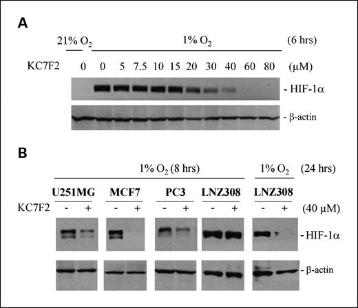 Identification of a Novel Small Molecule HIF-1α Translation Inhibitor ...