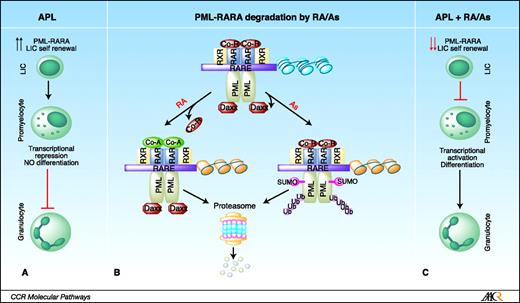 Therapy-induced PML/RARA Proteolysis and Acute Promyelocytic Leukemia ...