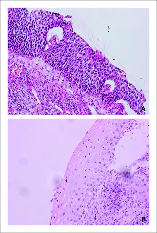 Dynamic Spectral Imaging: Improving Colposcopy | Clinical Cancer ...