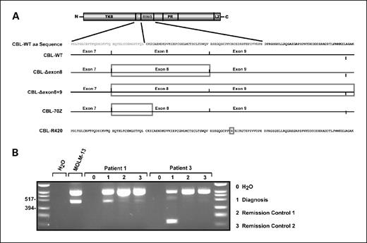 CBL Exon 8/9 Mutants Activate the FLT3 Pathway and Cluster in Core ...