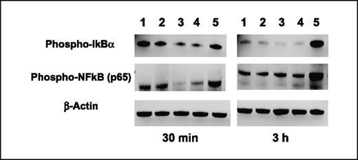 Combining Milatuzumab with Bortezomib, Doxorubicin, or Dexamethasone ...