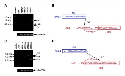 KIF5B-ALK, a Novel Fusion Oncokinase Identified by an ...
