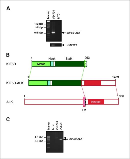 KIF5B-ALK, a Novel Fusion Oncokinase Identified by an ...