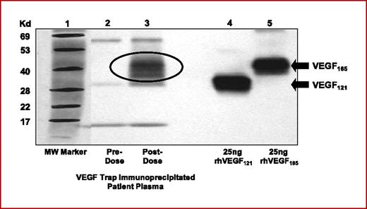 Phase 1 Study of Aflibercept Administered Subcutaneously to Patients ...