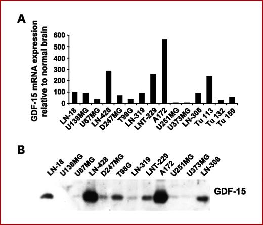 GDF-15 Contributes to Proliferation and Immune Escape of Malignant ...