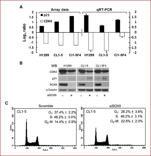 Upregulation of SOX9 in Lung Adenocarcinoma and Its Involvement in the ...
