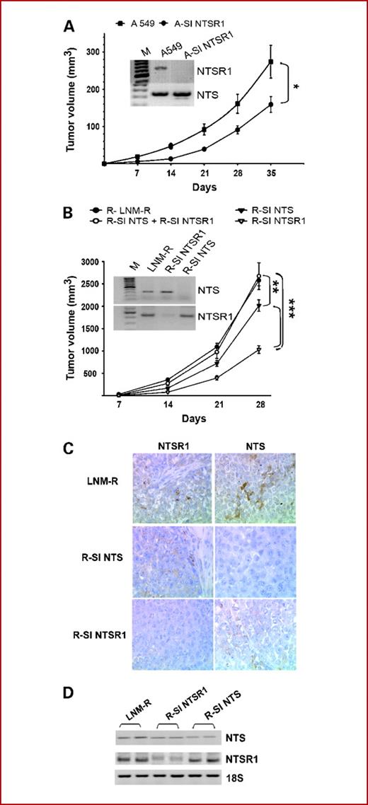 Neurotensin Receptor 1 Determines the Outcome of Non–Small Cell Lung ...
