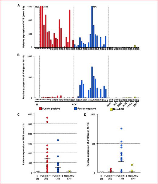 Comprehensive Analysis of the MYB-NFIB Gene Fusion in Salivary Adenoid ...