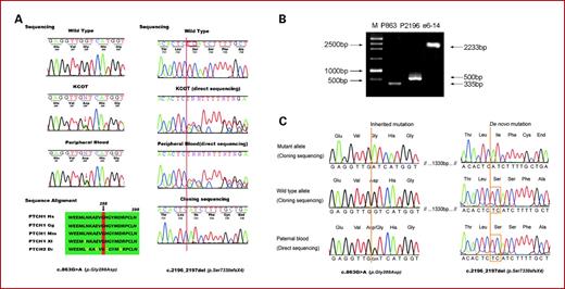 Mechanisms of Inactivation of PTCH1 Gene in Nevoid Basal Cell Carcinoma ...