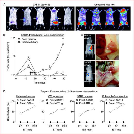 Eradication of Medullary Multiple Myeloma by CD4+ Cytotoxic Human T ...