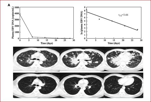 Plasma EBV DNA Clearance Rate as a Novel Prognostic Marker for ...