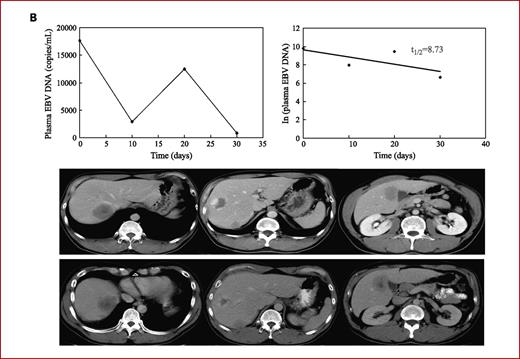 Plasma EBV DNA Clearance Rate as a Novel Prognostic Marker for ...