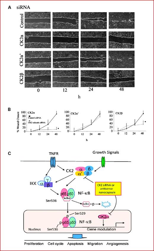 CK2 Modulation of NF-κB, TP53, and the Malignant Phenotype in Head and ...