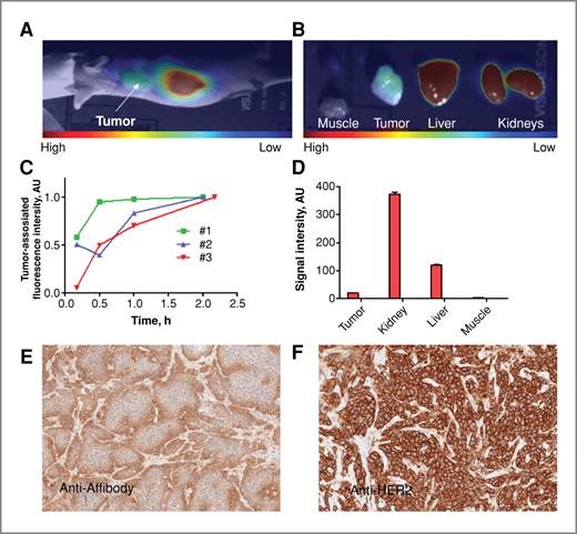 HER2-Affitoxin: A Potent Therapeutic Agent for the Treatment of HER2 ...