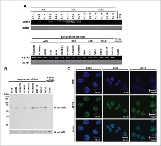 Characterization of a Cleavage Stimulation Factor, 3′ pre-RNA, Subunit ...
