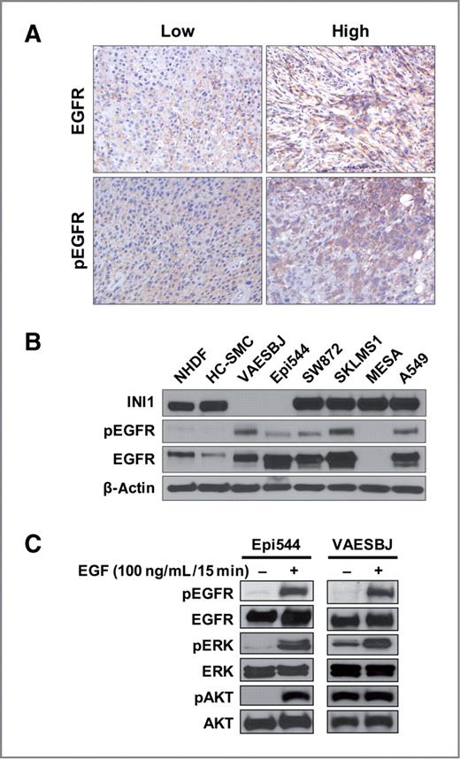 Combining EGFR and mTOR Blockade for the Treatment of Epithelioid ...